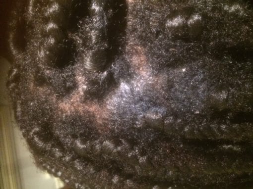 Afro Scalp Clinic London | Holborn Hair Scalp Clinic